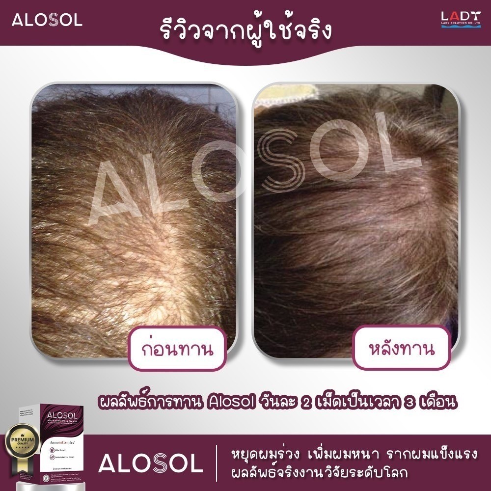 หน้าหลัก - Alosol Thailand